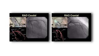 Cardiac Catheterization Laboratory | PPTX