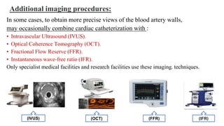 Cardiac Catheterization Laboratory | PPTX