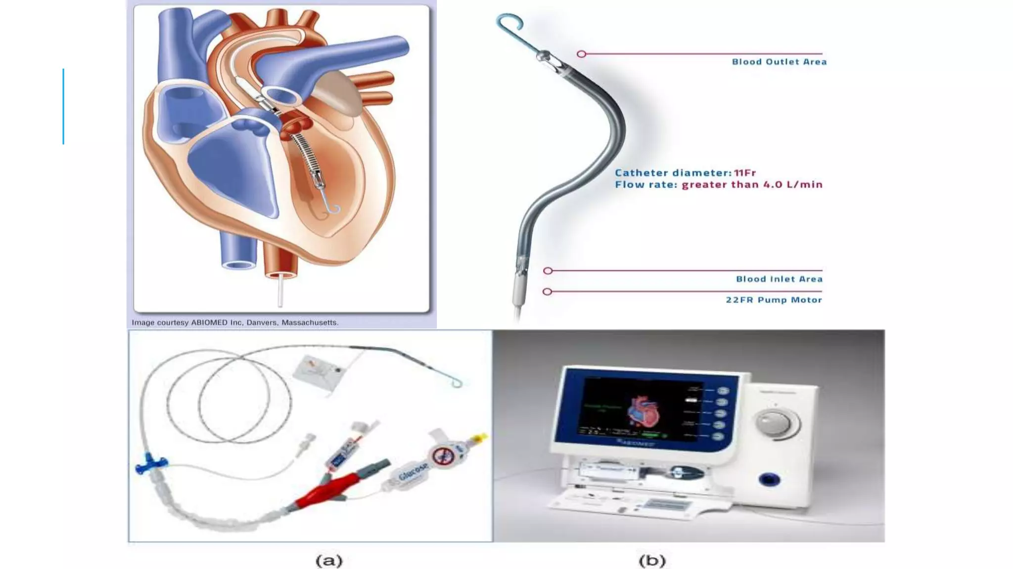 Cathlab procedures, it's contains what are the procedure doing in the ...