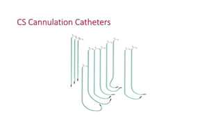 technical aspect of Left ventricular lead placement for CRT | PPTX