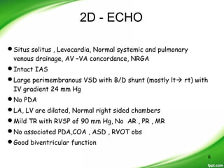 VSD PAH CATH MEET | PPT