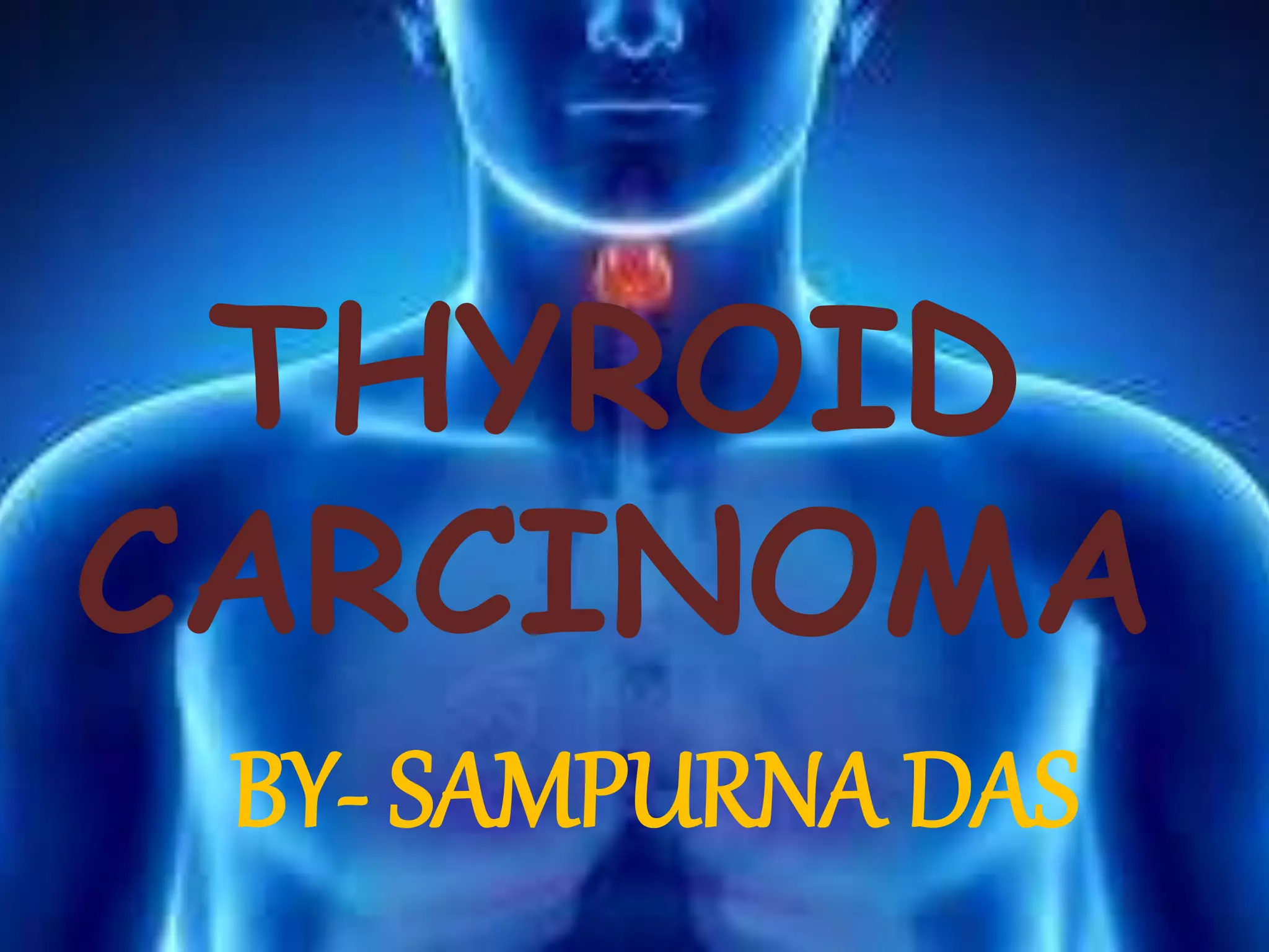 Ca thyroid | PPTX
