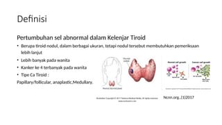 Ca thyroid deskripsi dan penjelasann.pptx