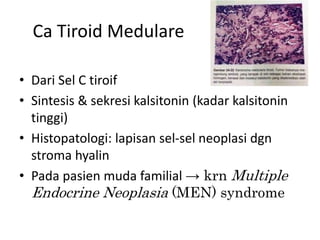 Ca tiroid | PPTX