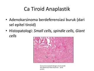 Ca tiroid | PPTX