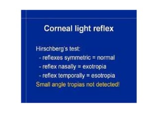 Catoptric images | PPTX