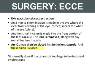 Catract ppt | PDF
