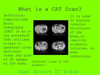 Cat Scans | PPT