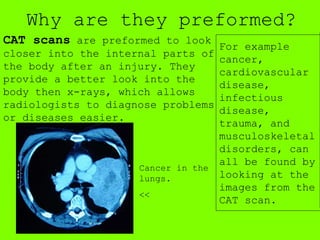 Cat Scans | PPT