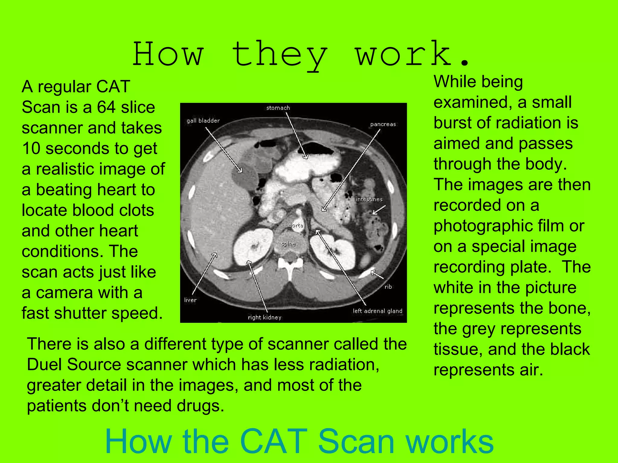 Cat Scans | PPT