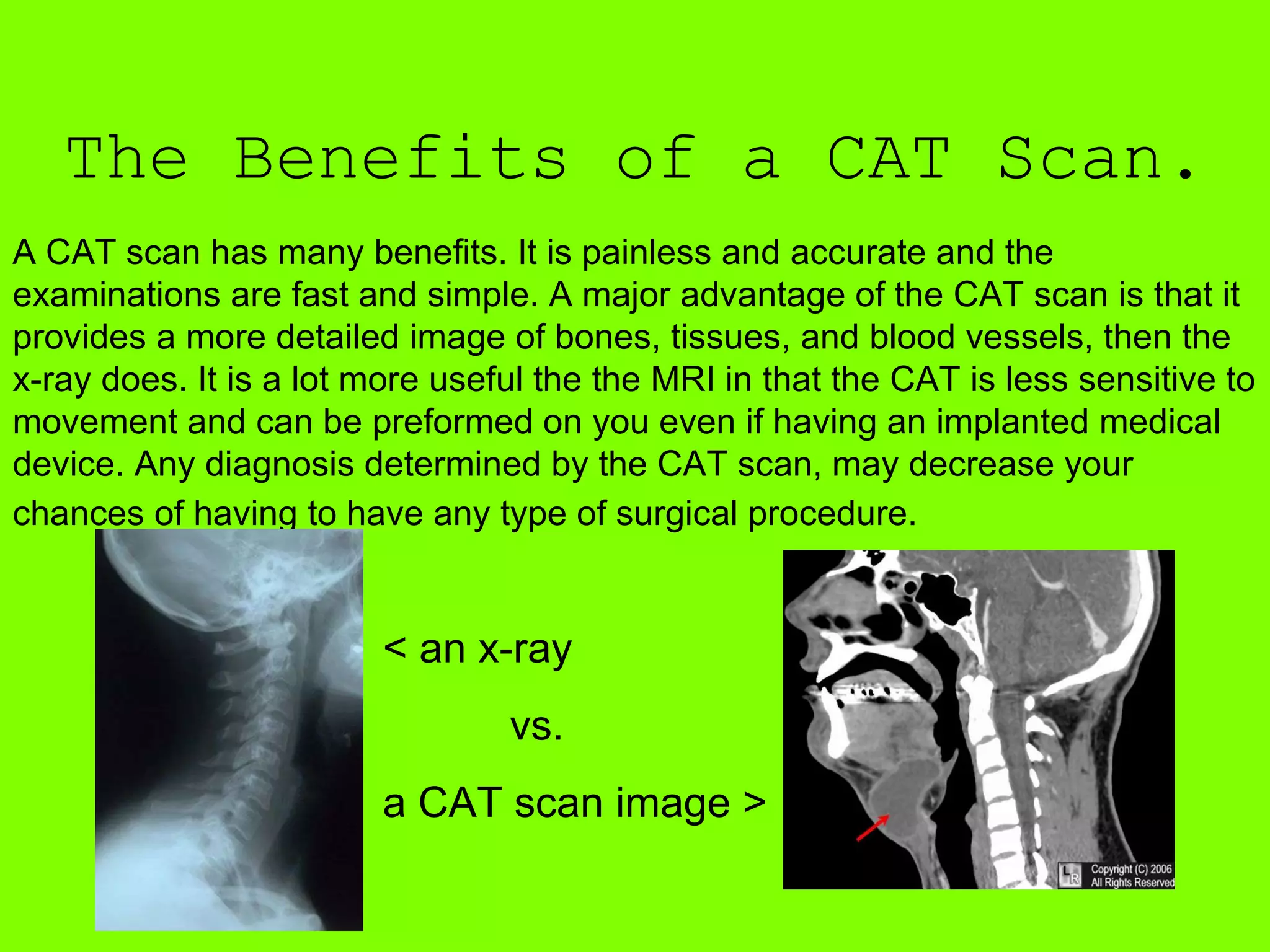 Cat Scans | PPT