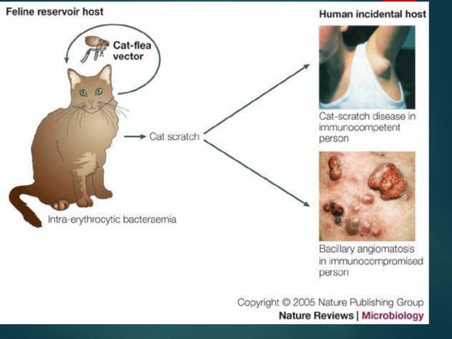 Cat scratch disease | PPTX