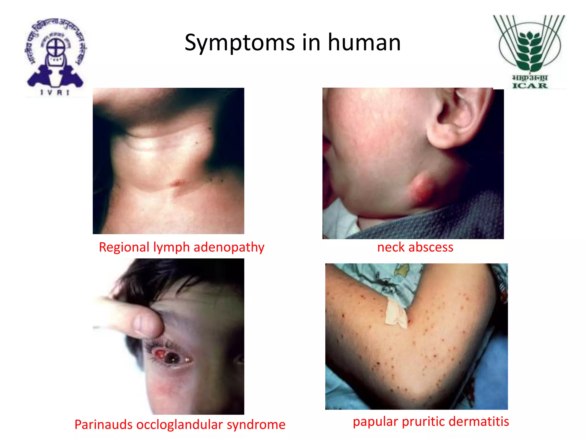 Cat scratch disease | PPTX