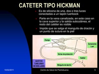 Catéteres Venosos Centrales | PPT