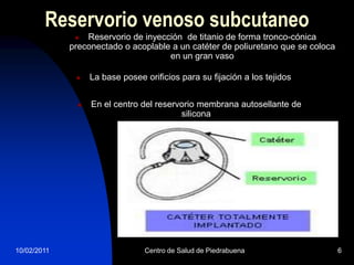 Catéteres Venosos Centrales | PPT