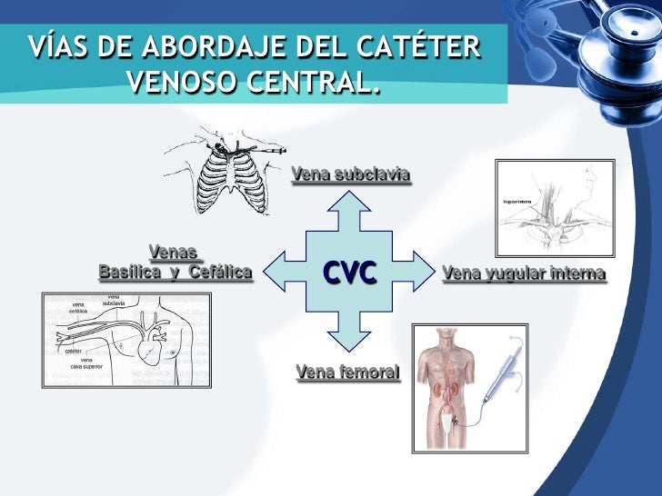 Cateter Venoso Central Vias De Acceso