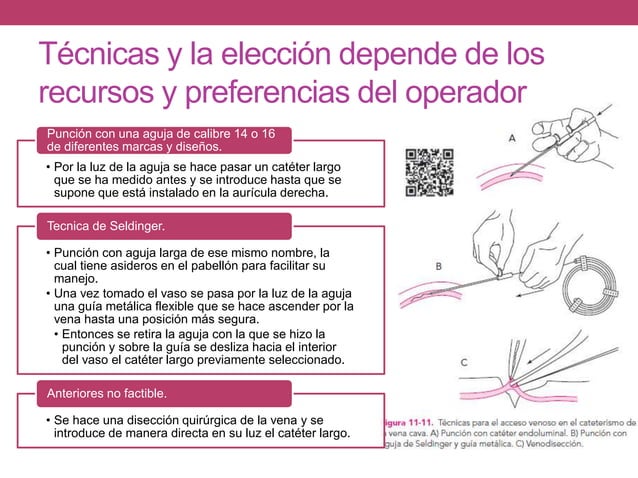 Catéter venoso central, punción subclavia y venodisecciones | PPT