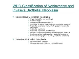 CARCINOMA URINARY BLADDER | PPT