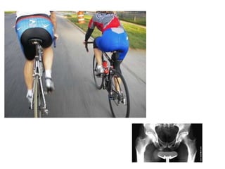 Cauda equina syndrome | PPT