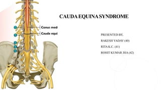 Cauda Equina Syndrome its Clinical features .pptx