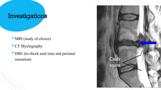 Cauda Equina Syndrome its Clinical features .pptx