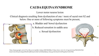 Cauda Equina Syndrome its Clinical features .pptx