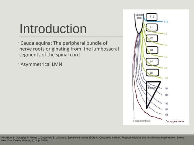 Cauda Equina Syndrome | PPT