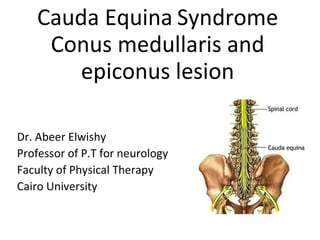 cauda equina syndrome 2021 (lumbar) .pdf