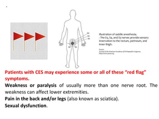 cauda equina syndrome 2021 (lumbar) .pdf