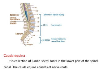 cauda equina syndrome 2021 (lumbar) .pdf