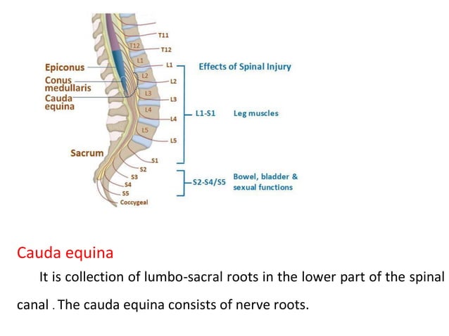 cauda equina syndrome 2021 (lumbar) .pdf