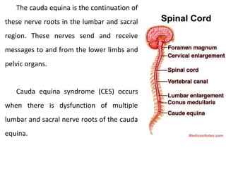 cauda equina syndrome 2021 (lumbar) .pdf