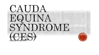 Cauda equina syndrome | PPTX