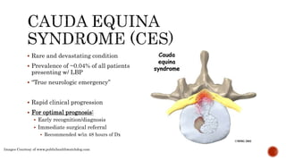 Cauda equina syndrome | PPTX