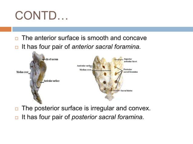 Caudal anesthesia | PPTX