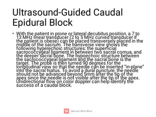 caudal anesthesia.pdf