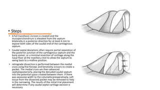 caudal devation correction.pptx