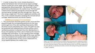 caudal devation correction.pptx