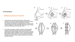caudal devation correction.pptx