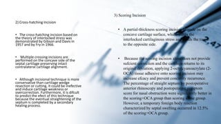 caudal devation correction.pptx