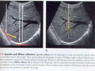 Specular Reflection Ultrasound
