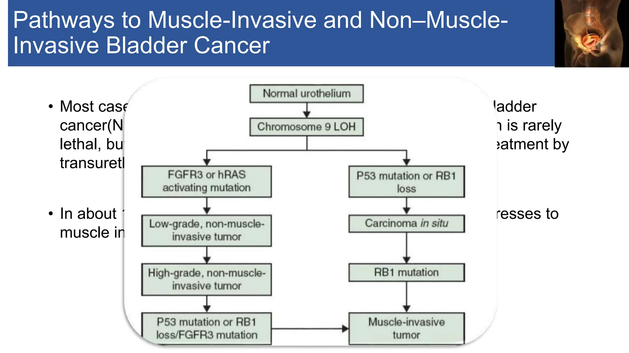 Ca Urinary Bladder anatomy to management | PPTX