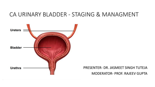 CA URINARY BLADDER - STAGING & MANAGMENT.pptx | Cancer | Diseases and ...