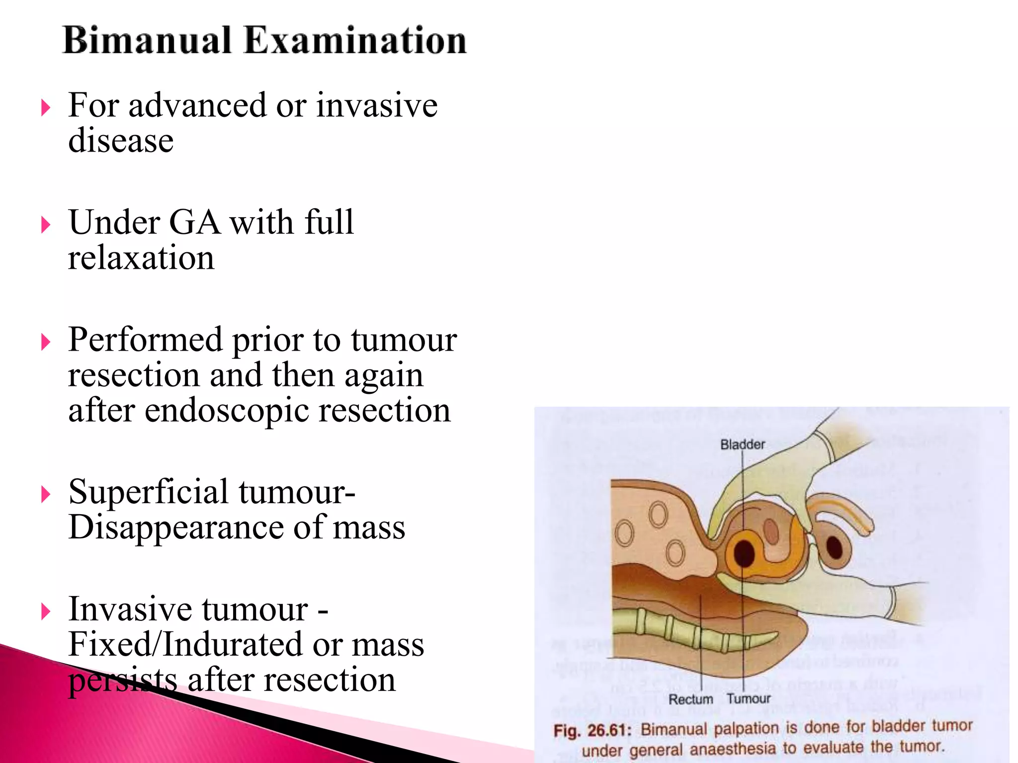 Ca urinary bladder management | PPTX