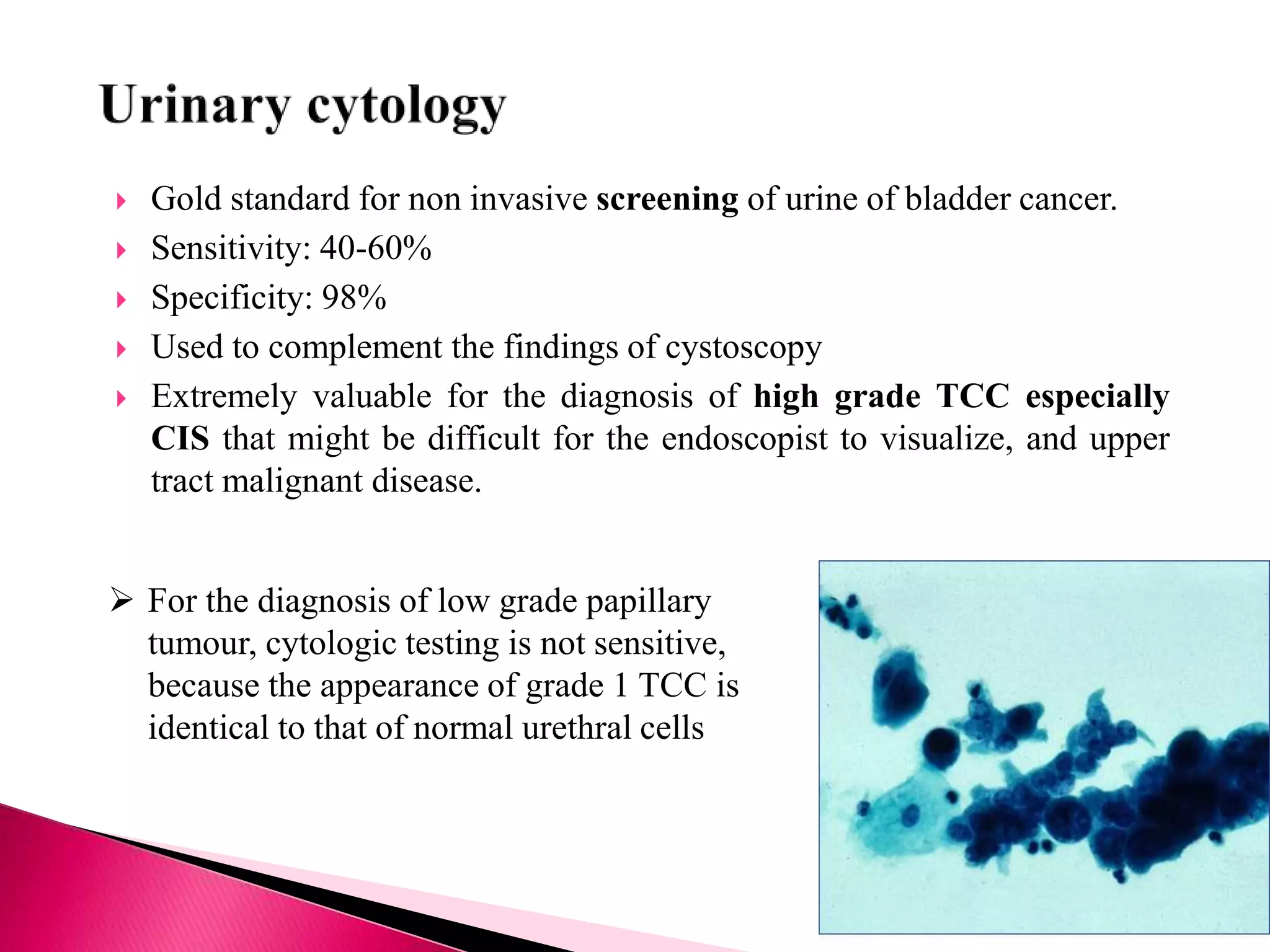 Ca urinary bladder management | PPTX