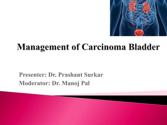 Ca urinary bladder management | PPTX