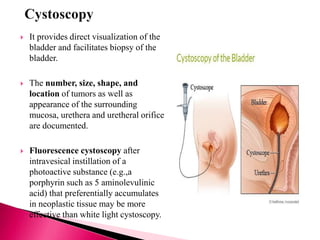Ca urinary bladder management | PPTX