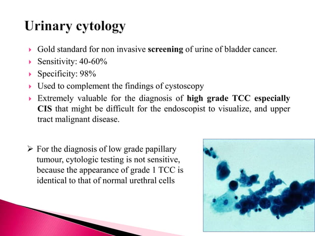 Ca urinary bladder management | PPTX