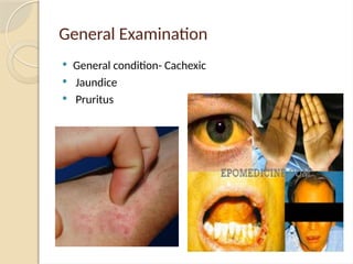 Causes and Clinical Features of Obstructive Jaundice.pptx