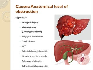 Causes and Clinical Features of Obstructive Jaundice.pptx